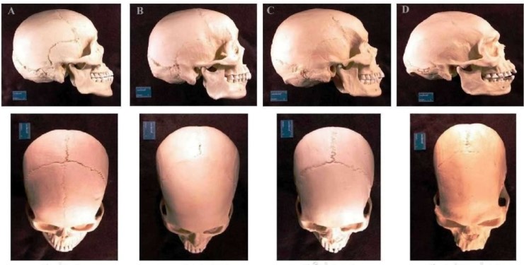 인종별 골상(skulls) 차이 - 황인, 흑인, 동양인 - 골상에서 얼굴모양이 나온다 : 네이버 블로그